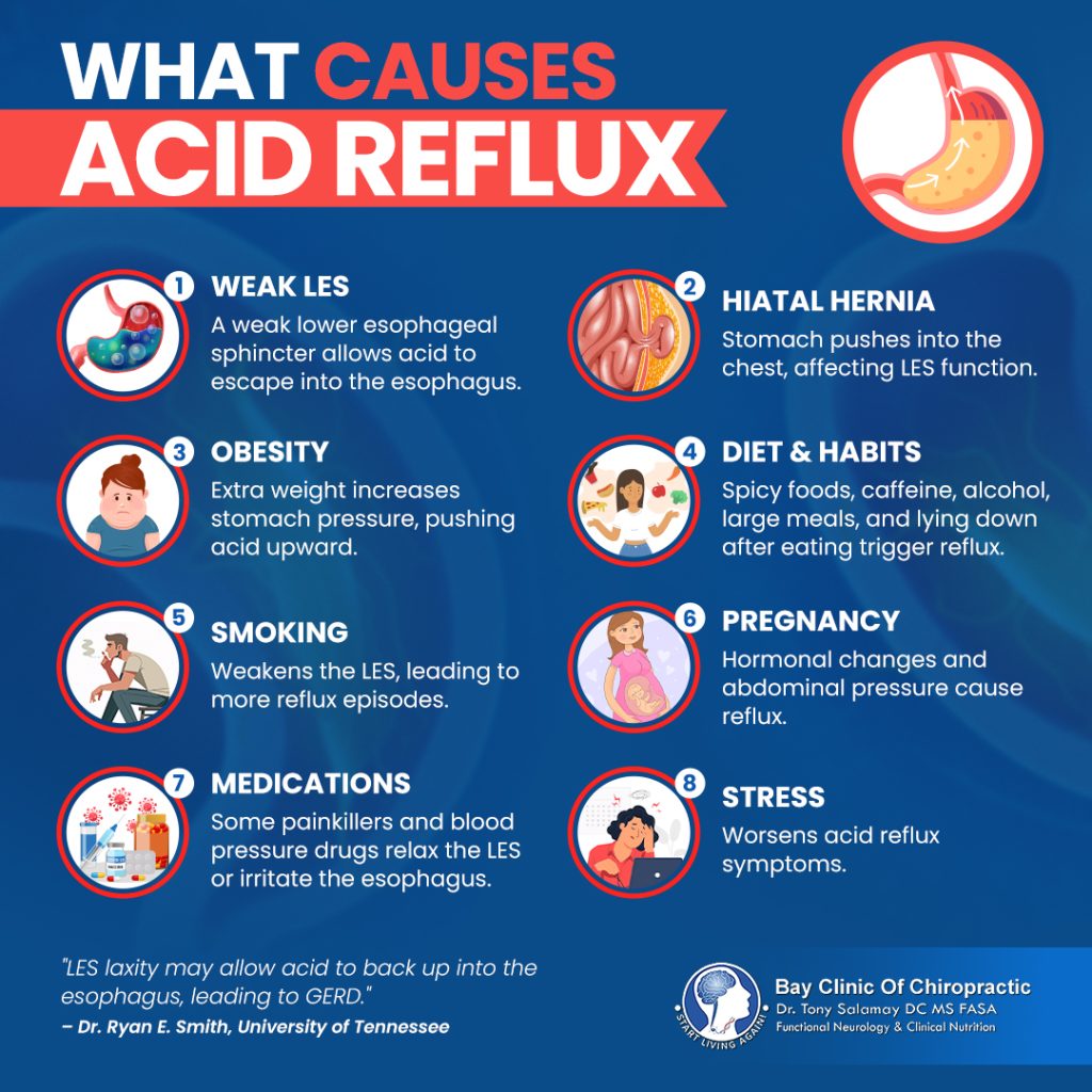 Acid Reflux (GERD): Symptoms, Causes and Natural Treatments