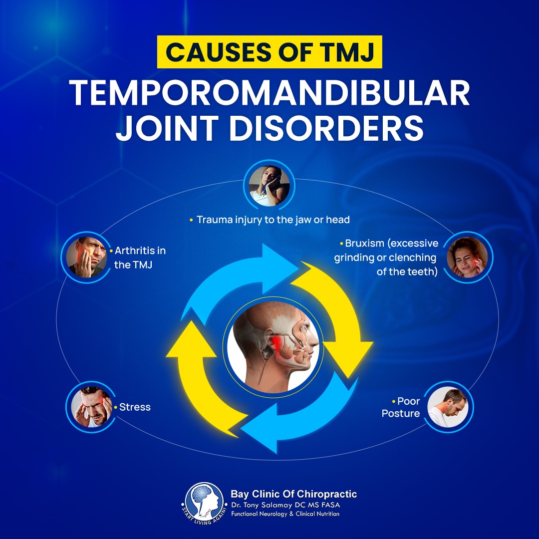 TMJ Disorders: Symptoms, Causes, and Natural Treatment Options