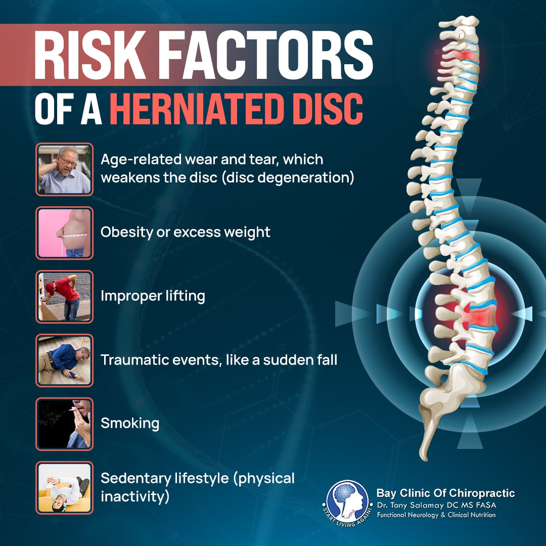 Herniated Disc: Symptoms, Causes and Chiropractic Treatments