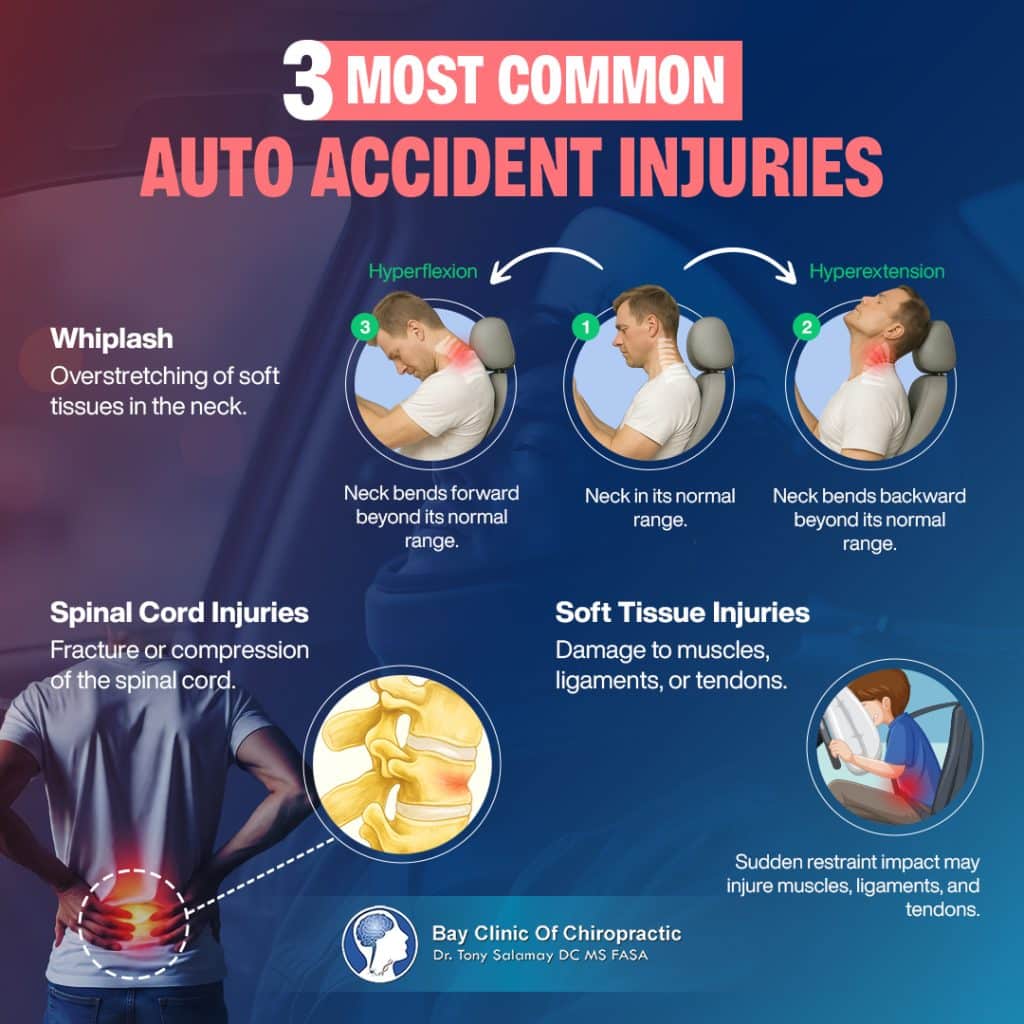 8 Common Auto Accident Injuries and Natural Treatment Options