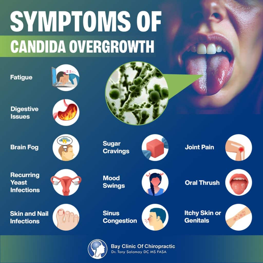 Candida Overgrowth: Signs, Causes, and Natural Remedies