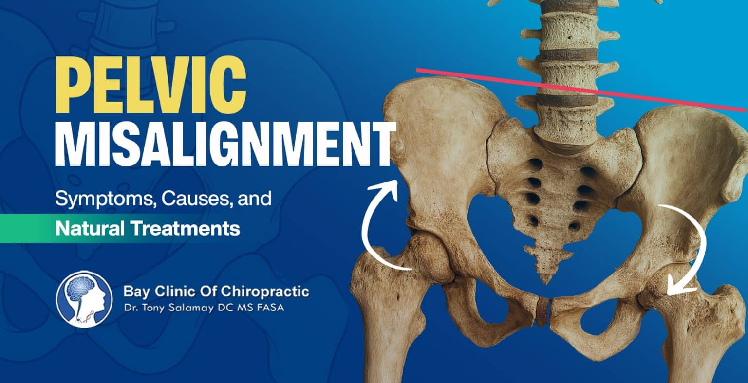 Pelvic Misalignment: Signs, Causes & Natural Treatment Options
