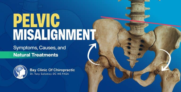 Pelvic Misalignment: Signs, Causes & Natural Treatment Options