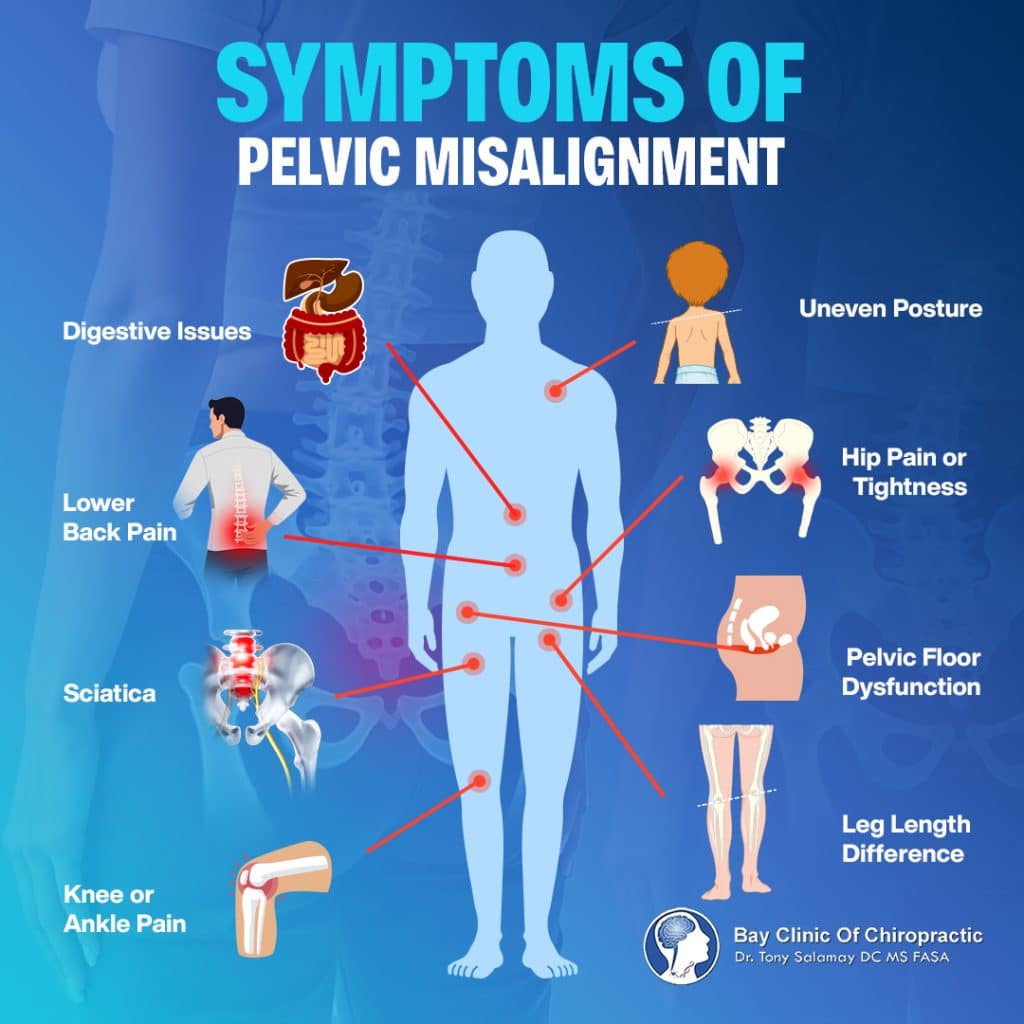 Pelvic Misalignment: Signs, Causes & Natural Treatment Options