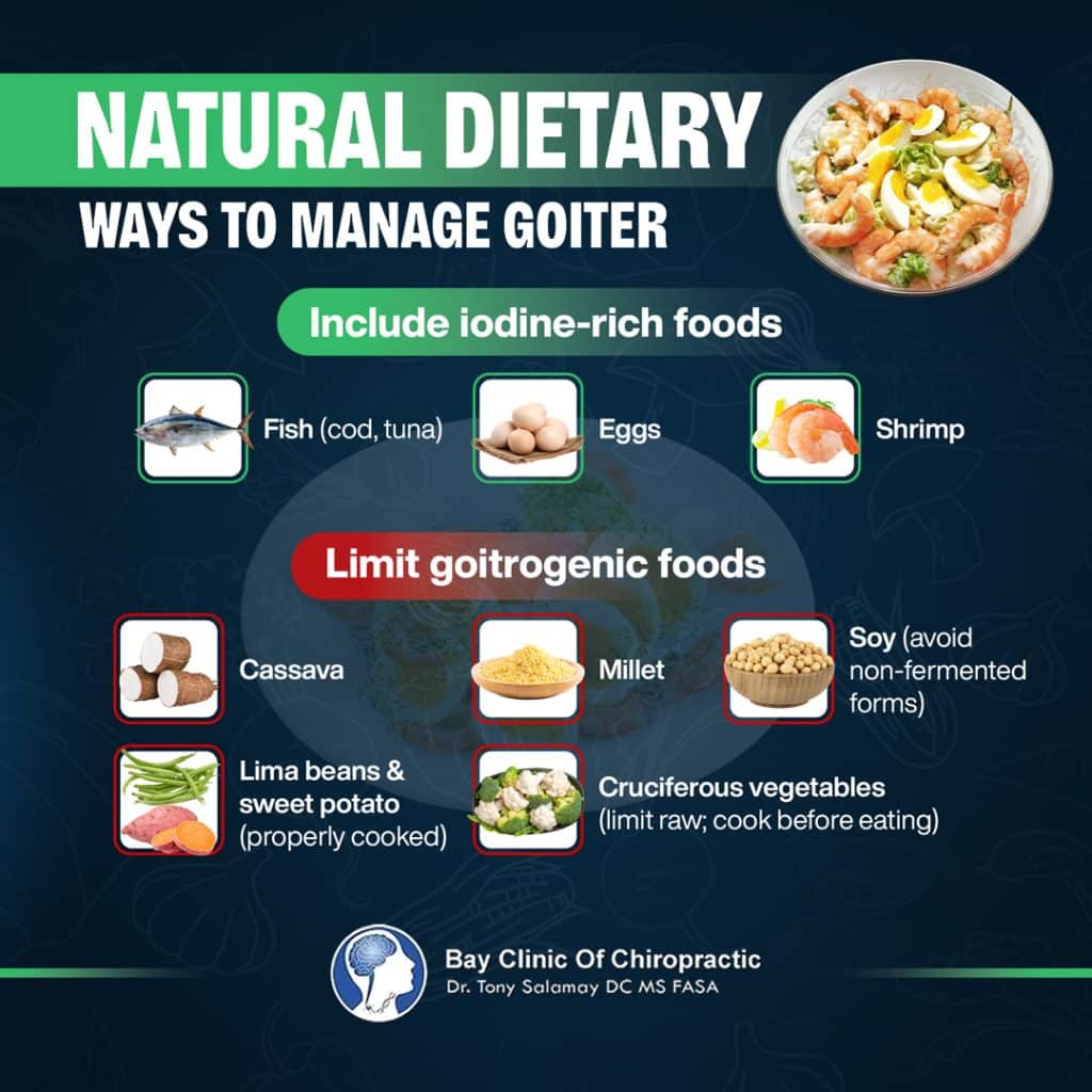 Goiter: Symptoms, Causes and Natural Treatment
